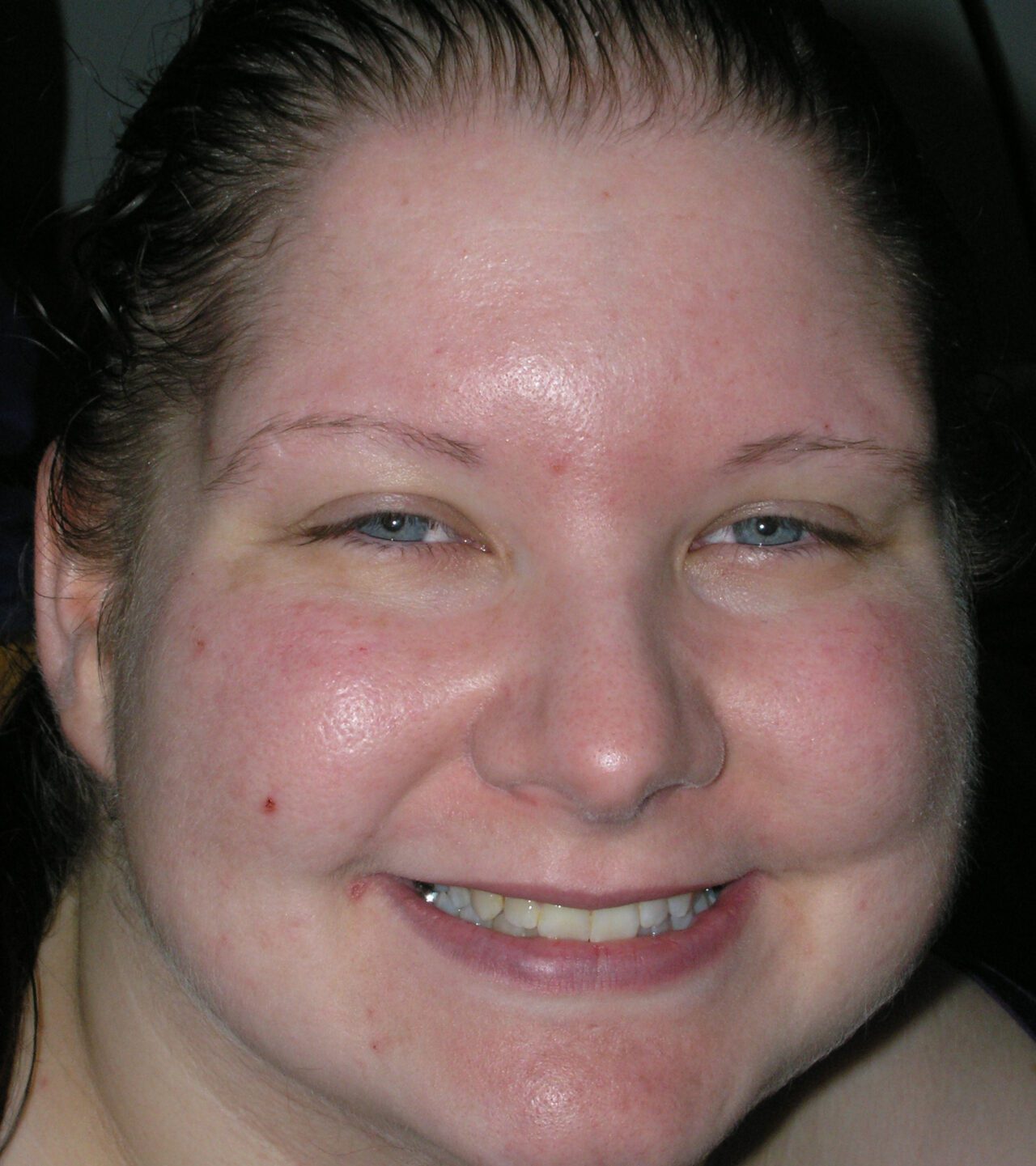 April - Emergency Dental Care & In Home Dentisty in San Francisco